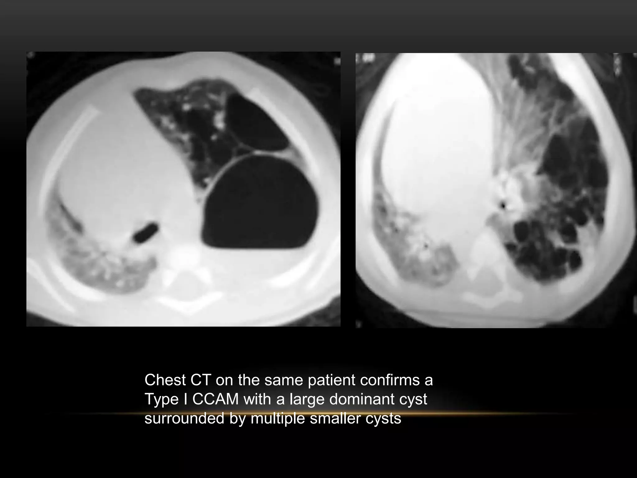 Paediatric chest imaging | PPTX