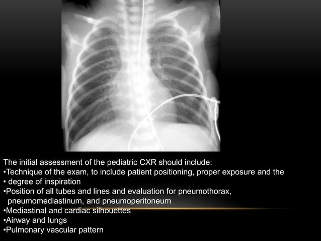 Paediatric chest imaging | PPTX | Lung and Respiratory Health ...