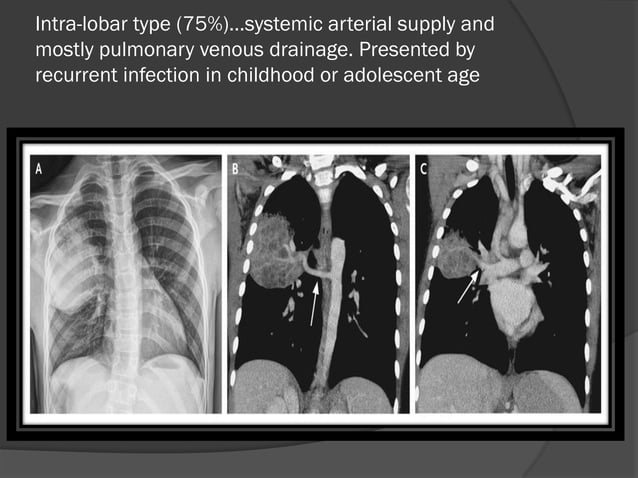 Paediatric chest imaging | PDF | Lung and Respiratory Health | Diseases ...