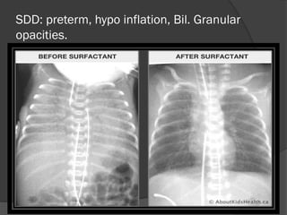 Paediatric chest imaging | PDF
