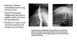 Paediatric chest by Dr. Kamal | PPTX