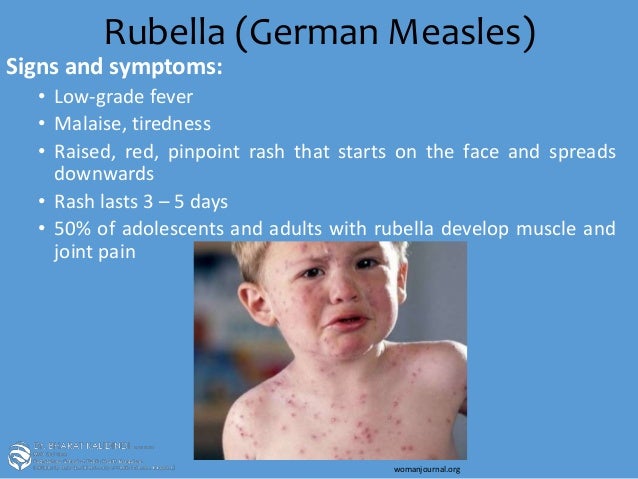 Range Of Low Grade Fever In Adults - trendyrevizion