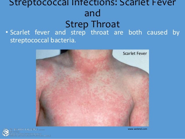 Paediatric Infectious diseases