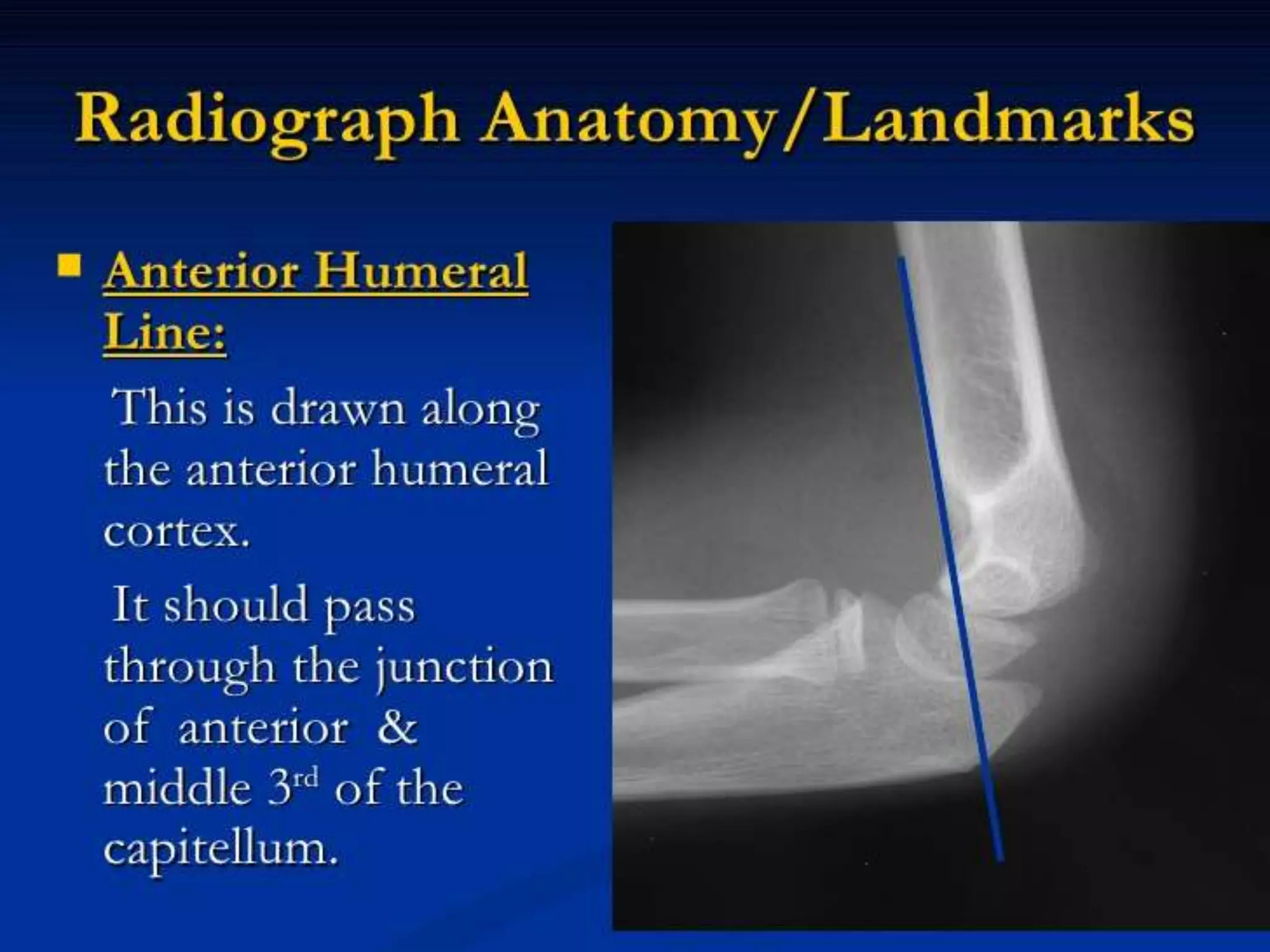 Radiographic evaluation of Paediatric elbow injury | PPTX