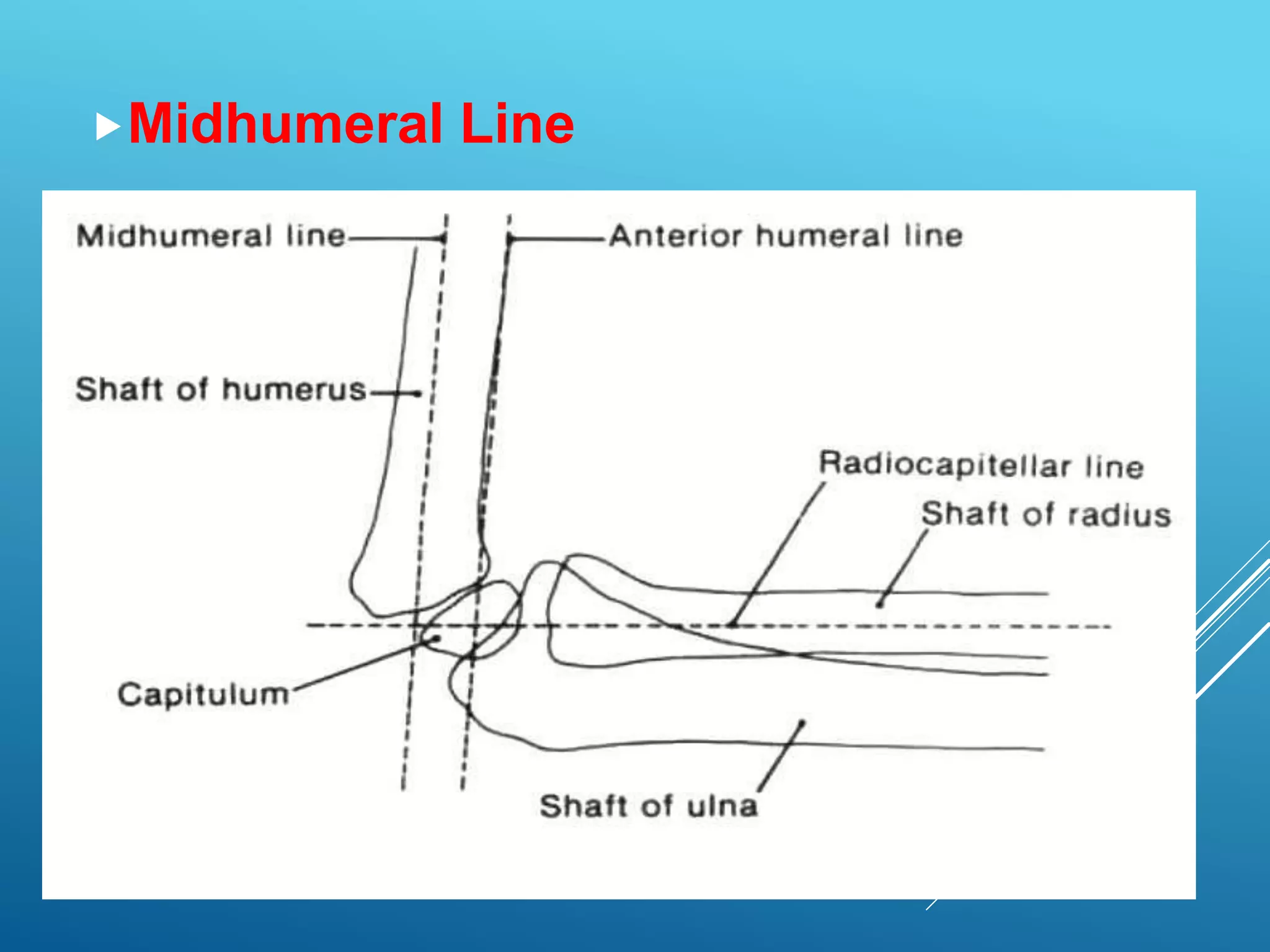 Radiographic evaluation of Paediatric elbow injury | PPTX