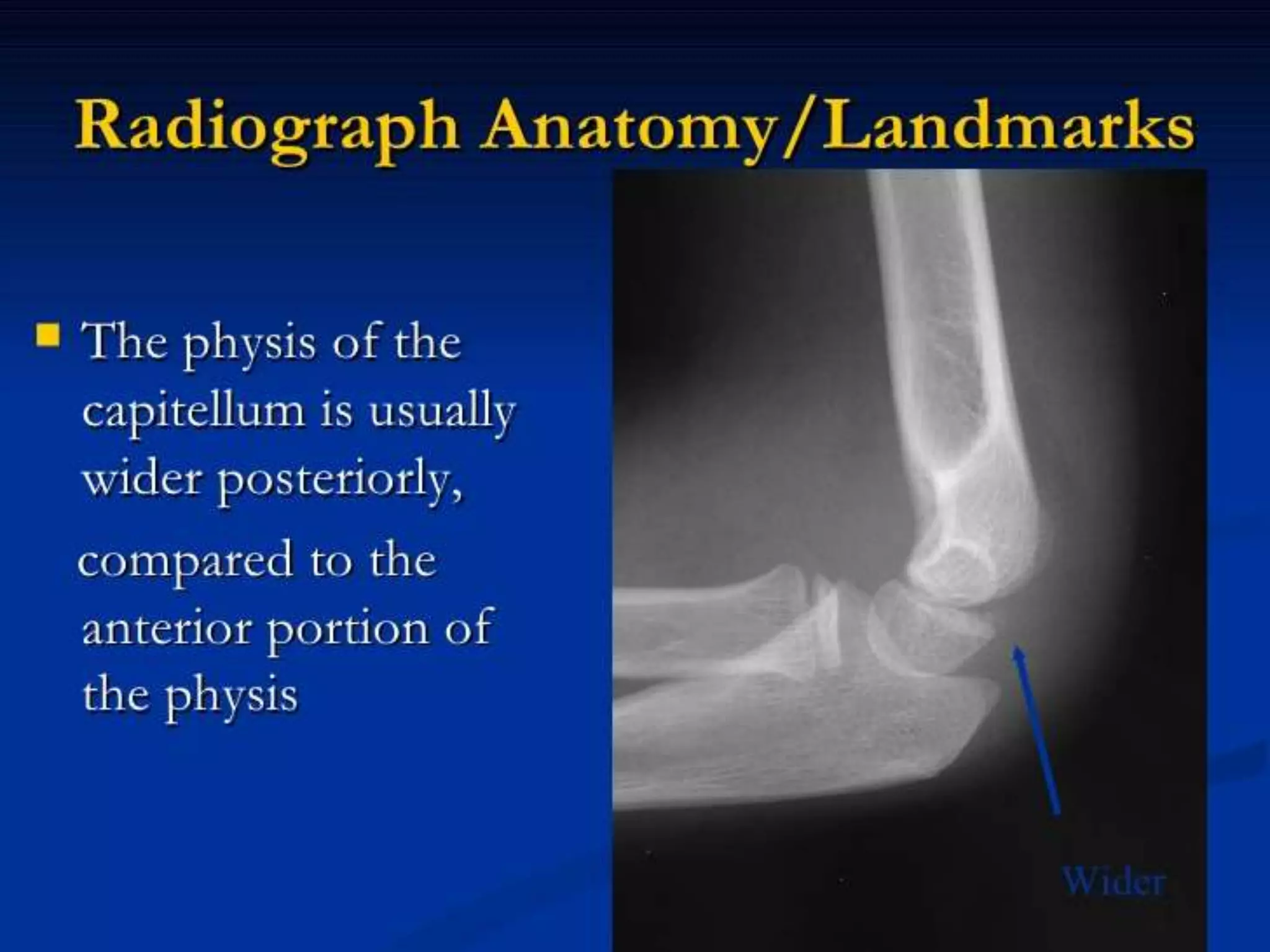 Radiographic evaluation of Paediatric elbow injury | PPTX