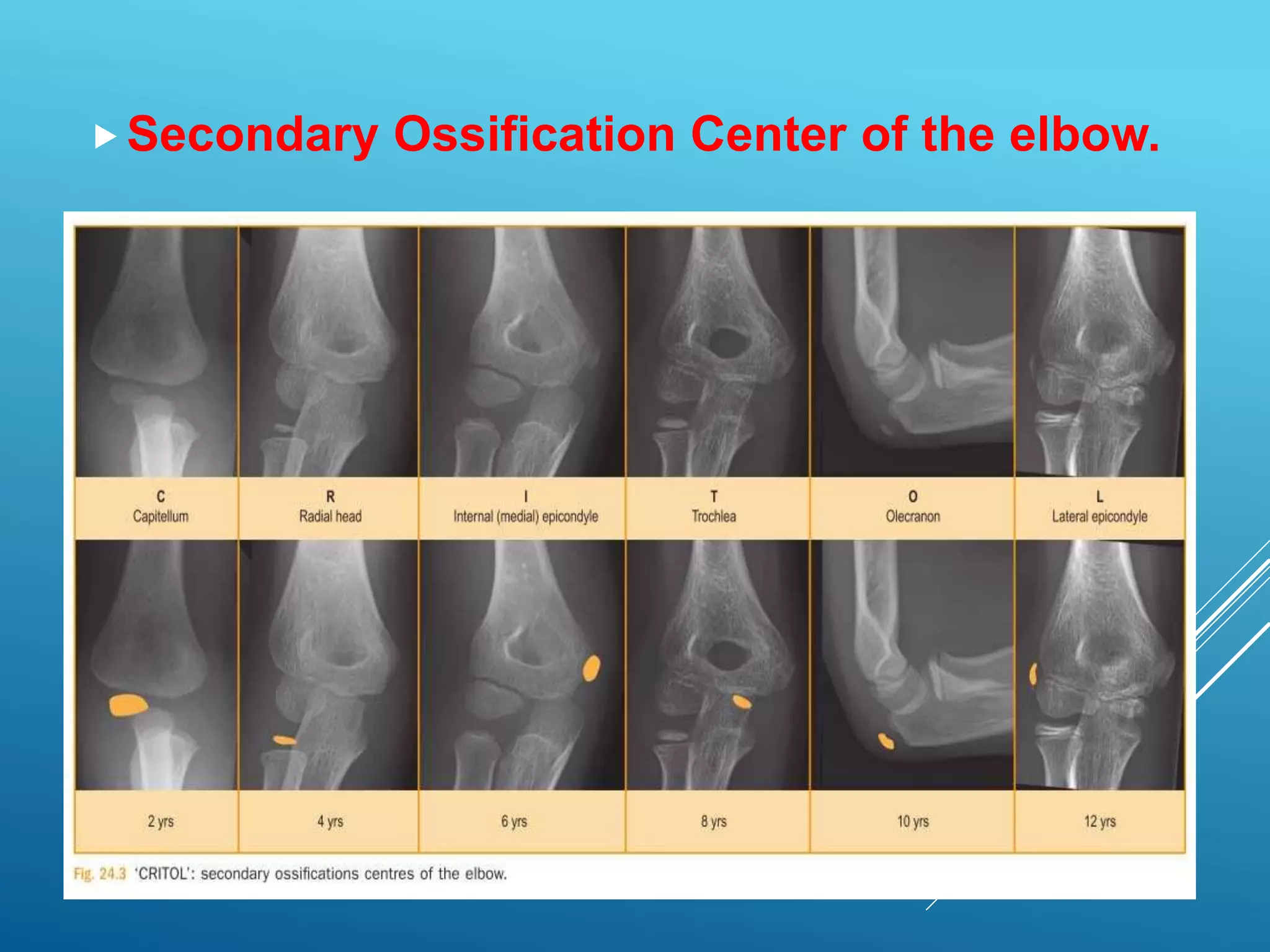 Radiographic evaluation of Paediatric elbow injury | PPTX