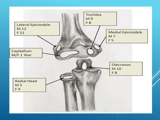 Radiographic evaluation of Paediatric elbow injury | PPTX