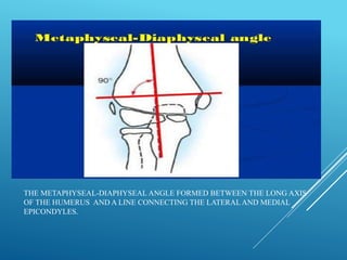 Radiographic evaluation of Paediatric elbow injury | PPTX