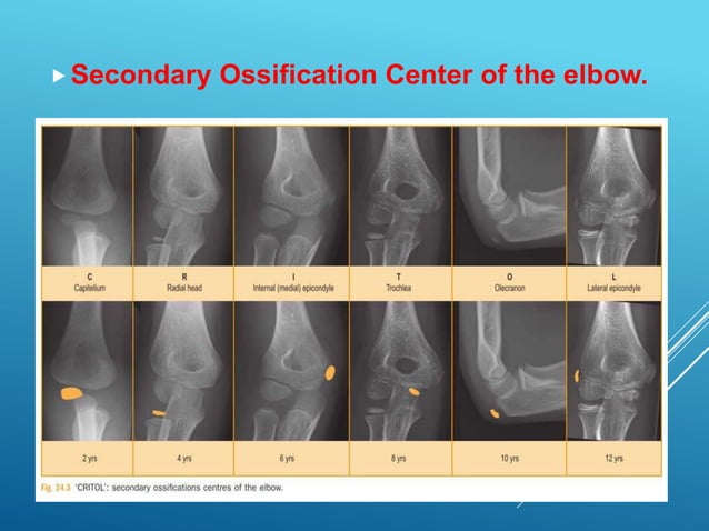 Radiographic evaluation of Paediatric elbow injury | PPTX