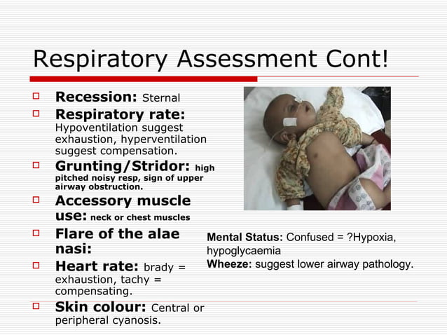 Paediatric Emergencies | PPT