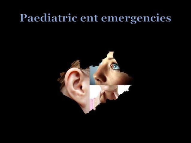 Paediatric ent emergencies | PPTX