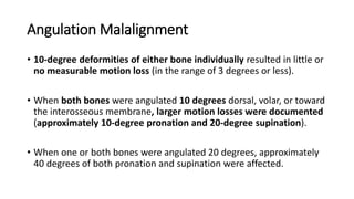 Paediatricforearmdiaphysialfractures | PPT