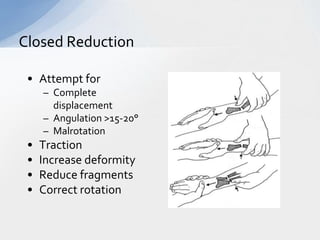Paediatric forearm fractures | PPTX