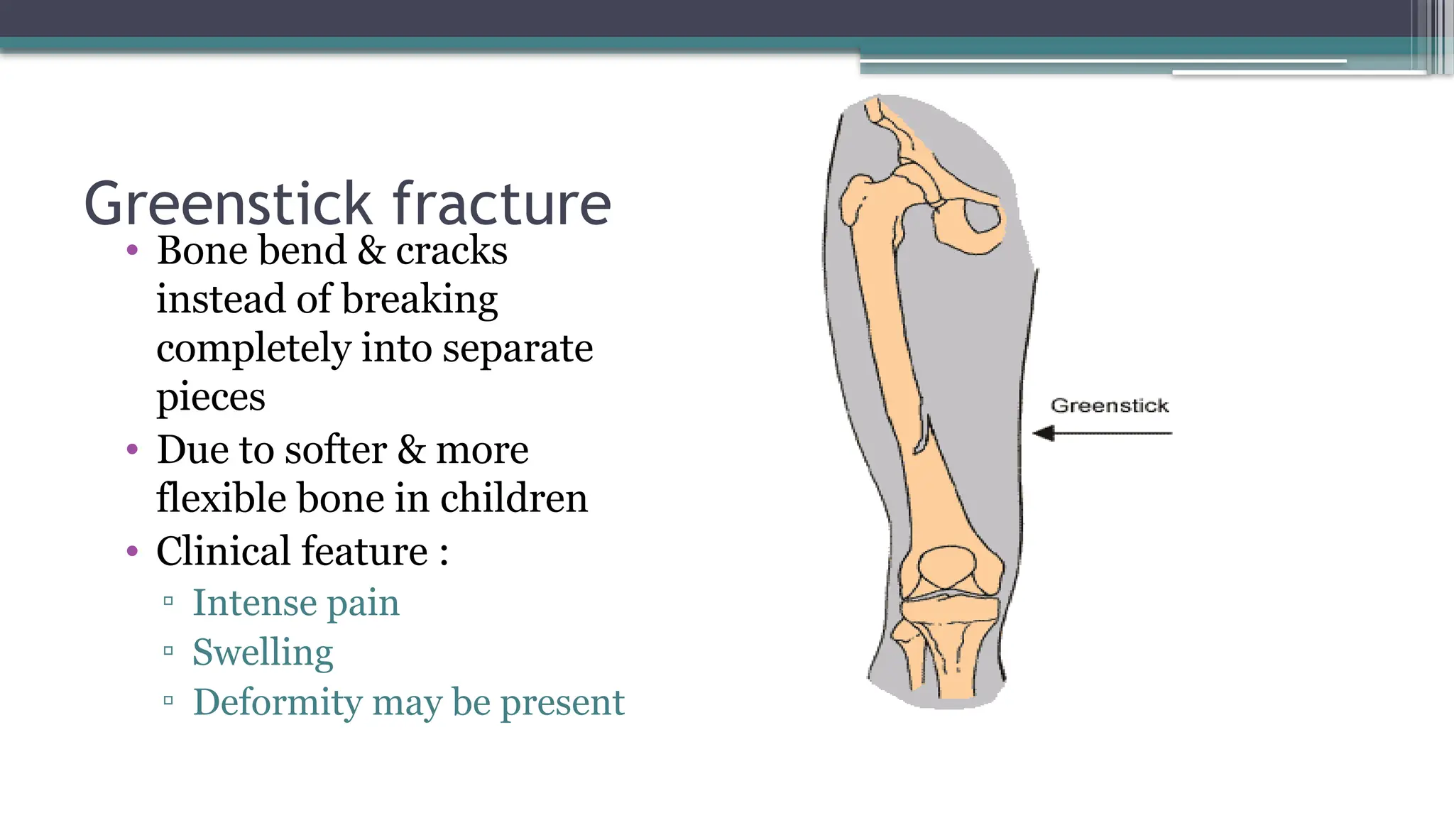 Paediatric Fractures and Management.pptx