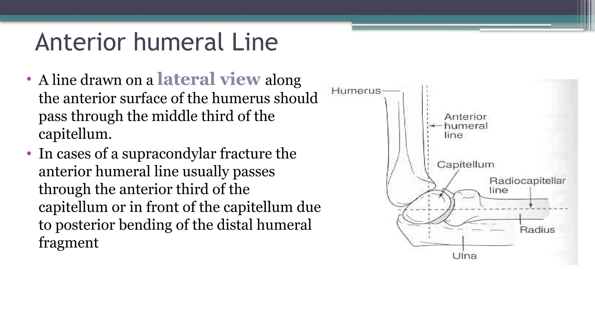 Paediatric Fractures and Management.pptx