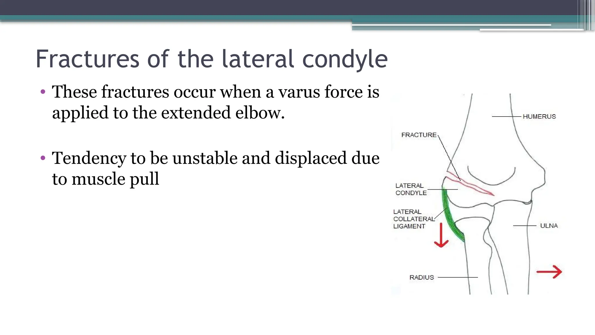 Paediatric Fractures and Management.pptx