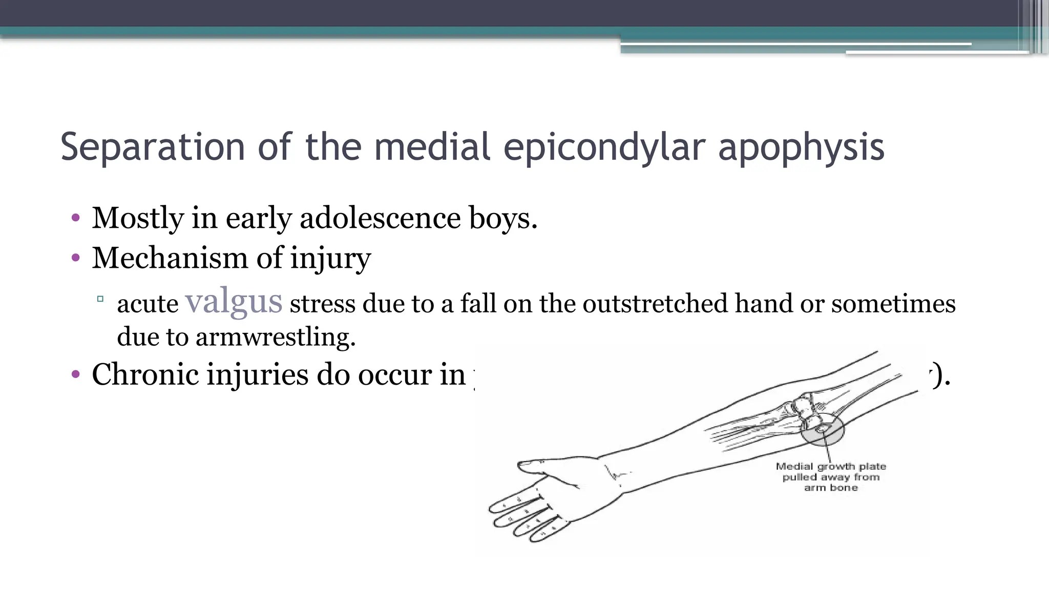 Paediatric Fractures and Management.pptx