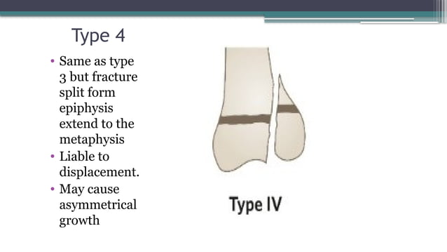 Paediatric Fractures and Management.pptx