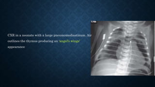 Paediatric imaging rapid review of radiology | PPTX