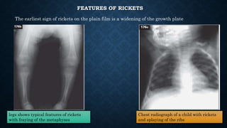 Paediatric imaging rapid review of radiology | PPTX