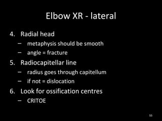 Paediatric Fractures for SCH ED | PPT