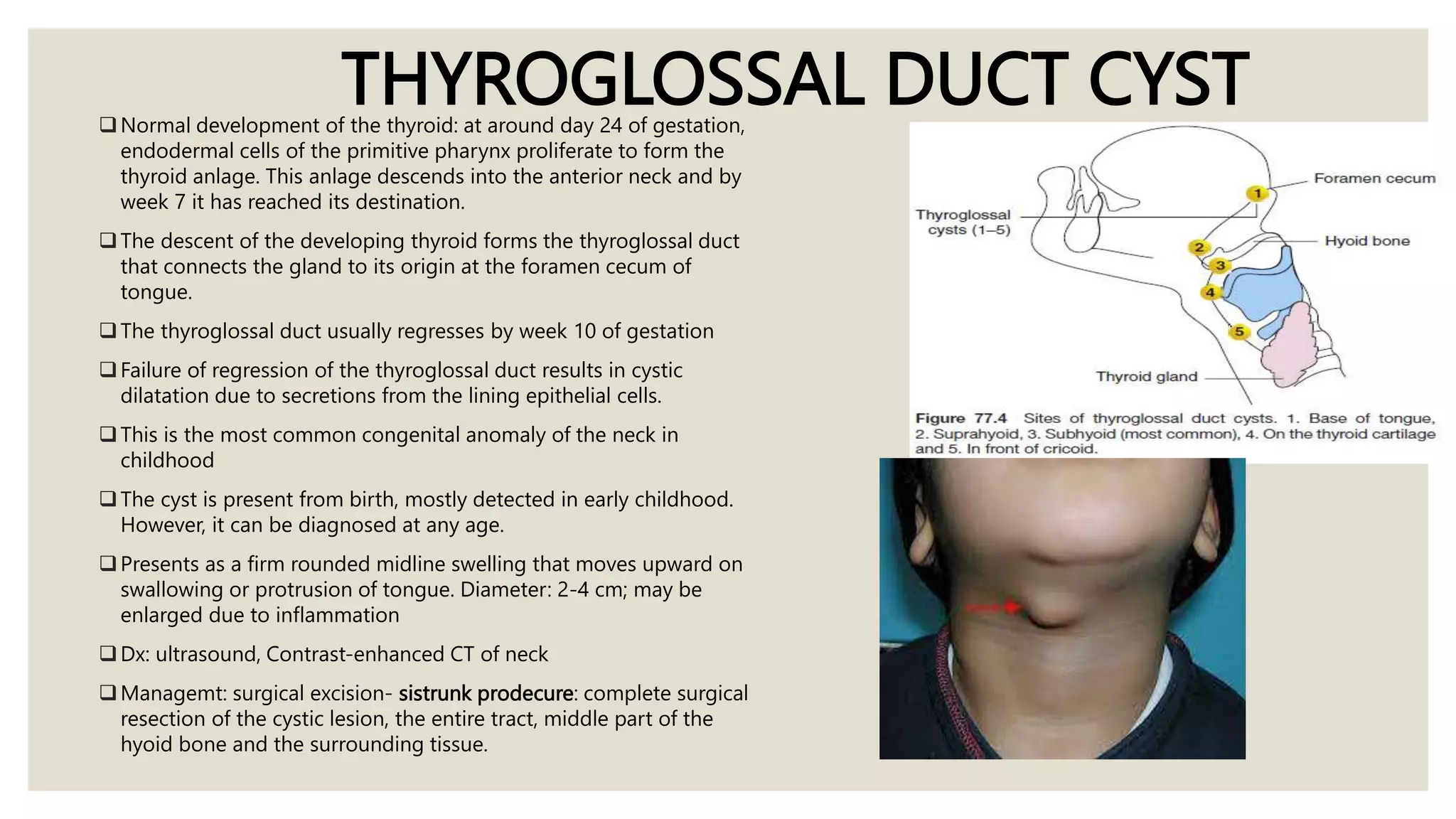 PAEDIATRIC MASSES OF THE NECK..pptx