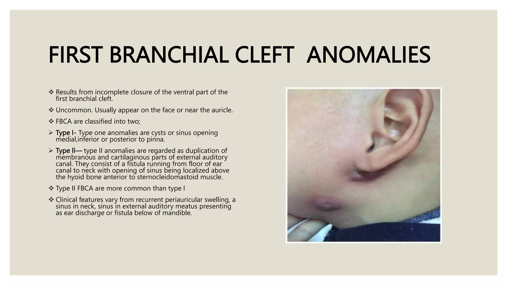 PAEDIATRIC MASSES OF THE NECK..pptx