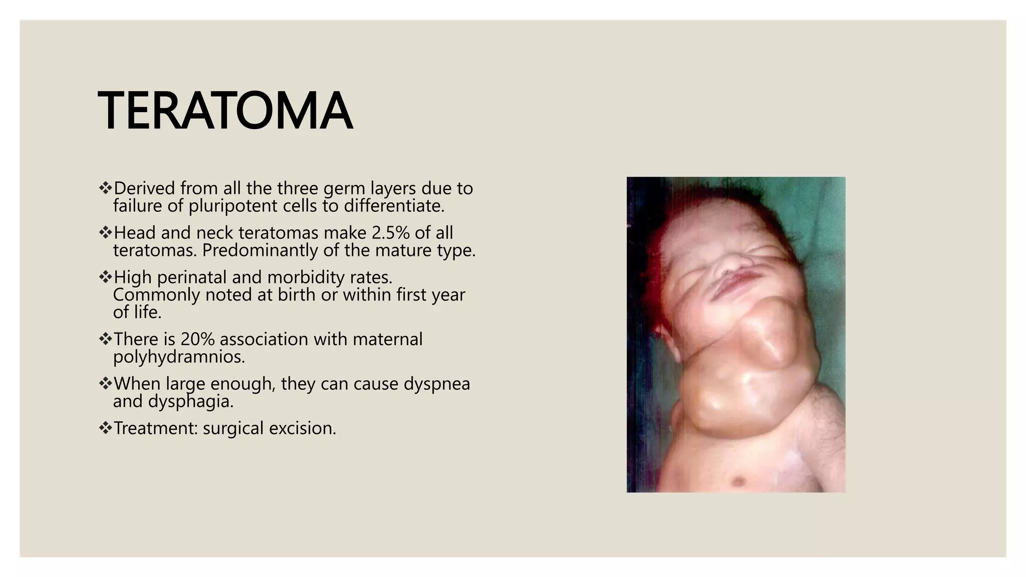 PAEDIATRIC MASSES OF THE NECK..pptx