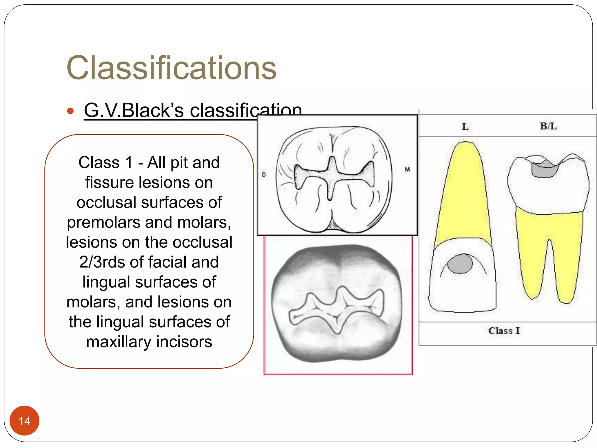 Paediatric operative dentistry | PPTX