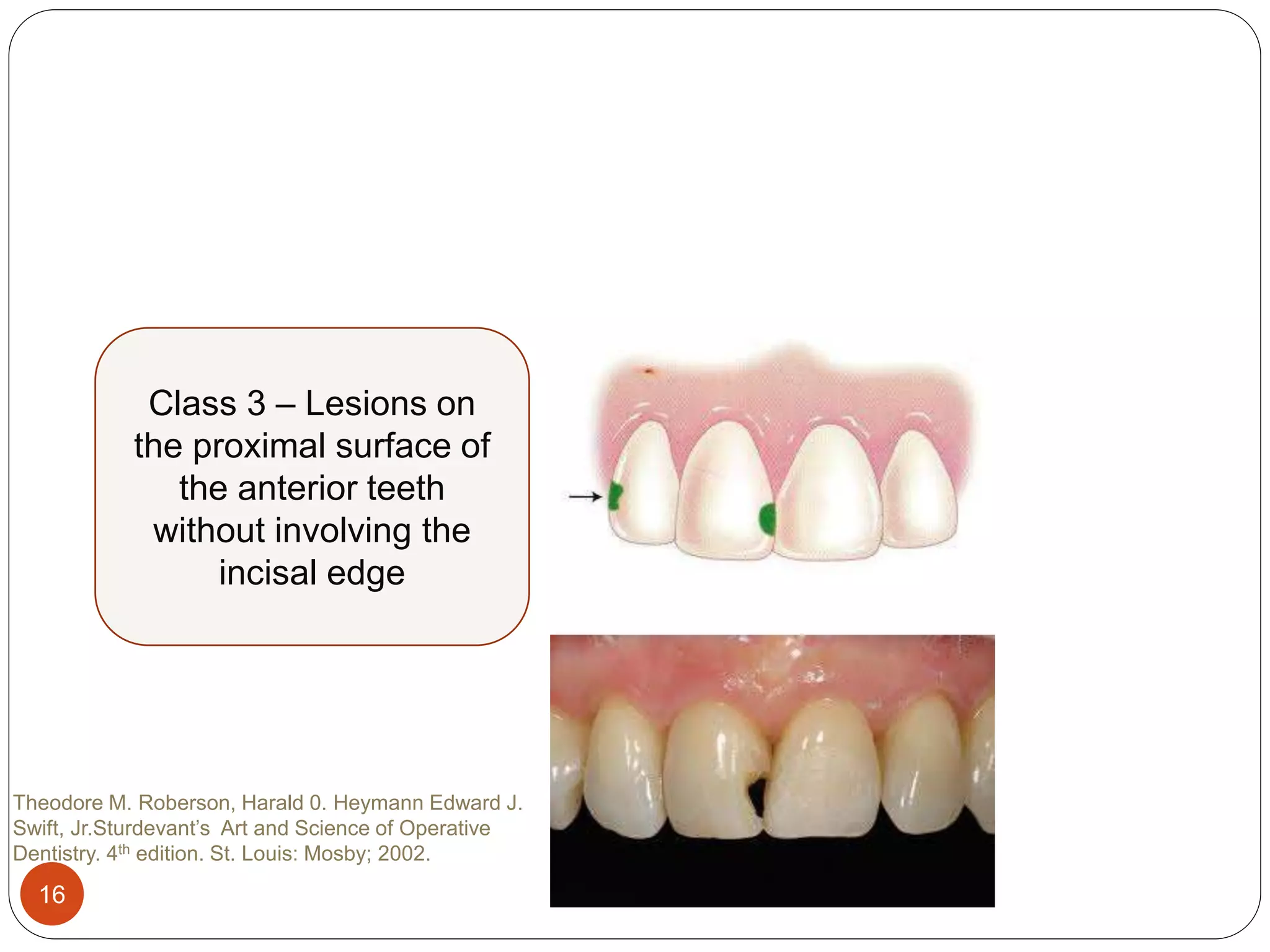 Paediatric operative dentistry | PPTX