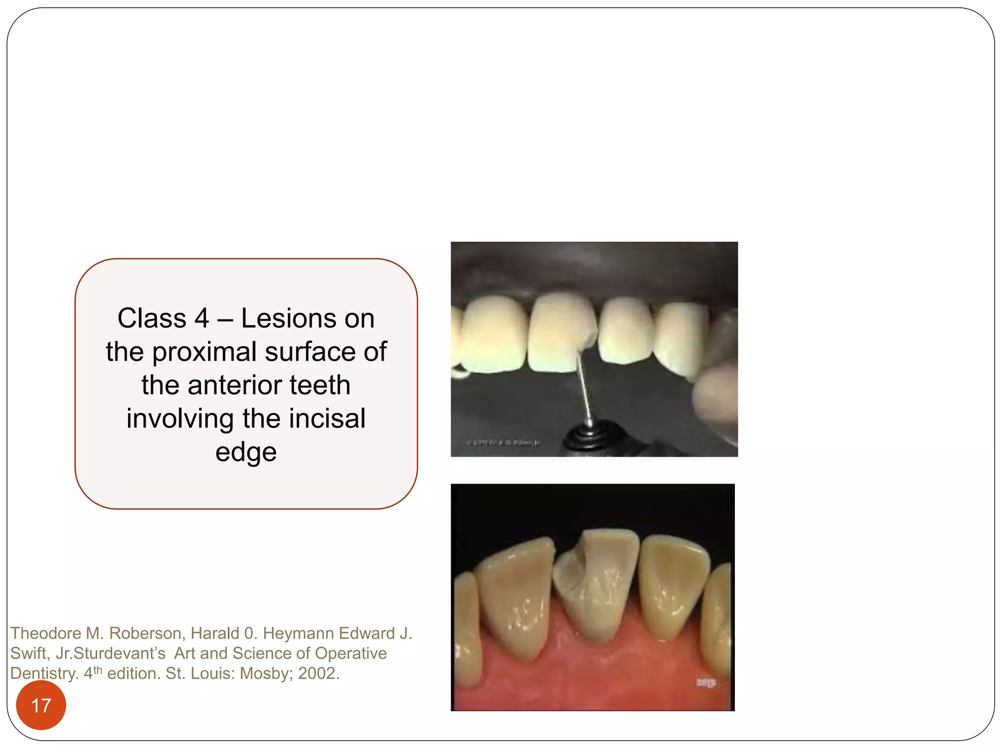 Paediatric operative dentistry | PPTX
