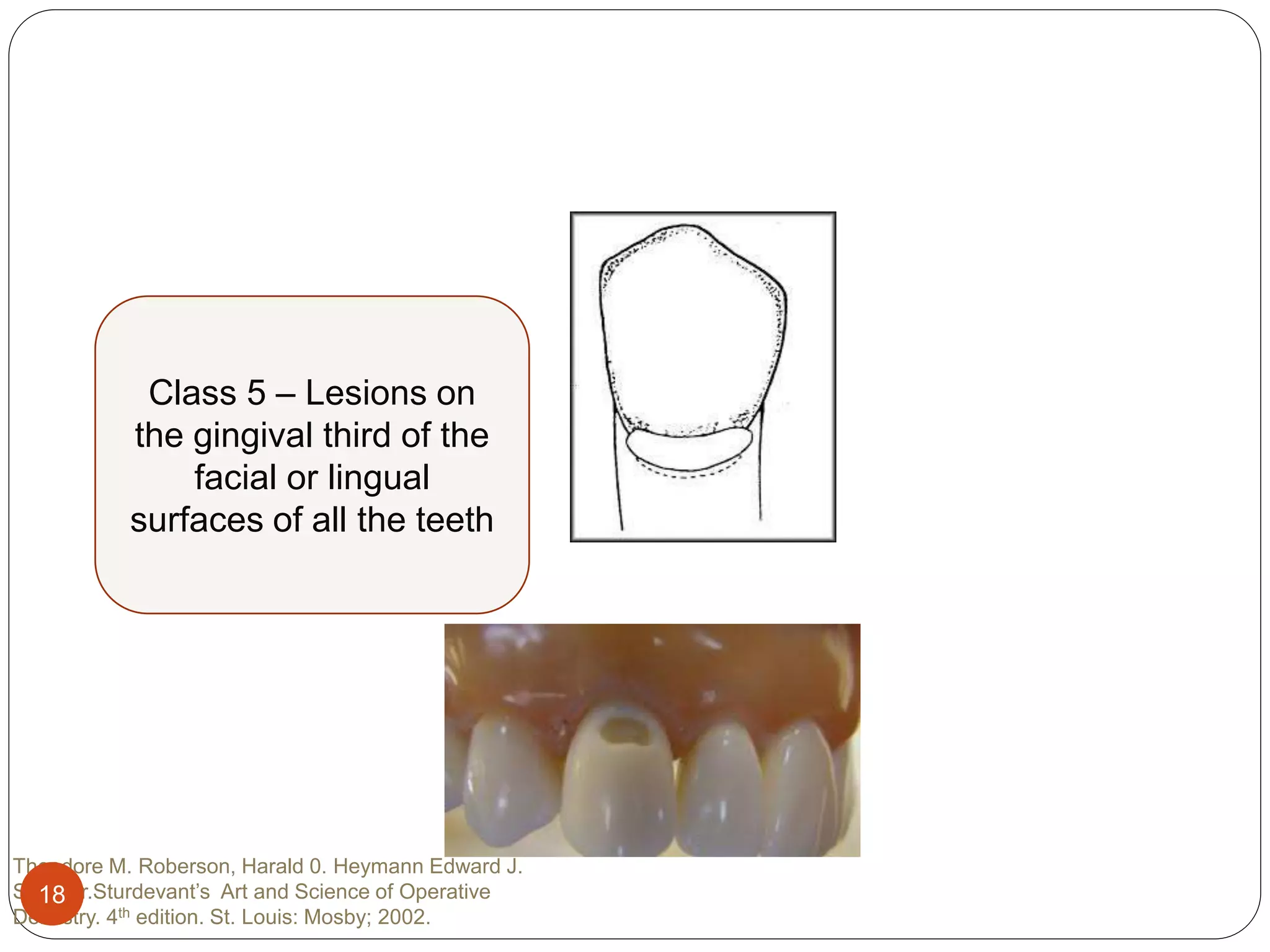 Paediatric operative dentistry | PPTX