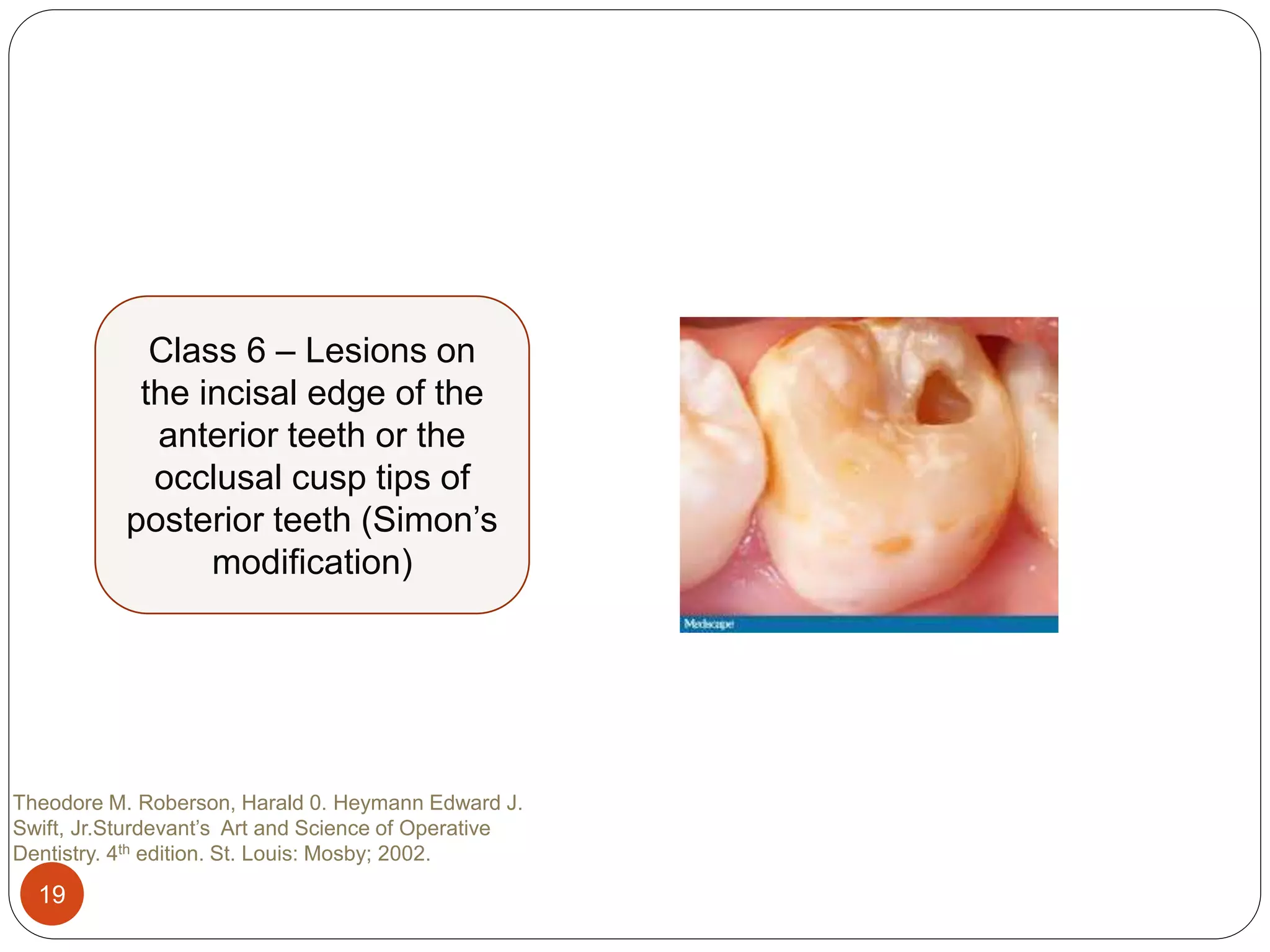 Paediatric operative dentistry | PPTX