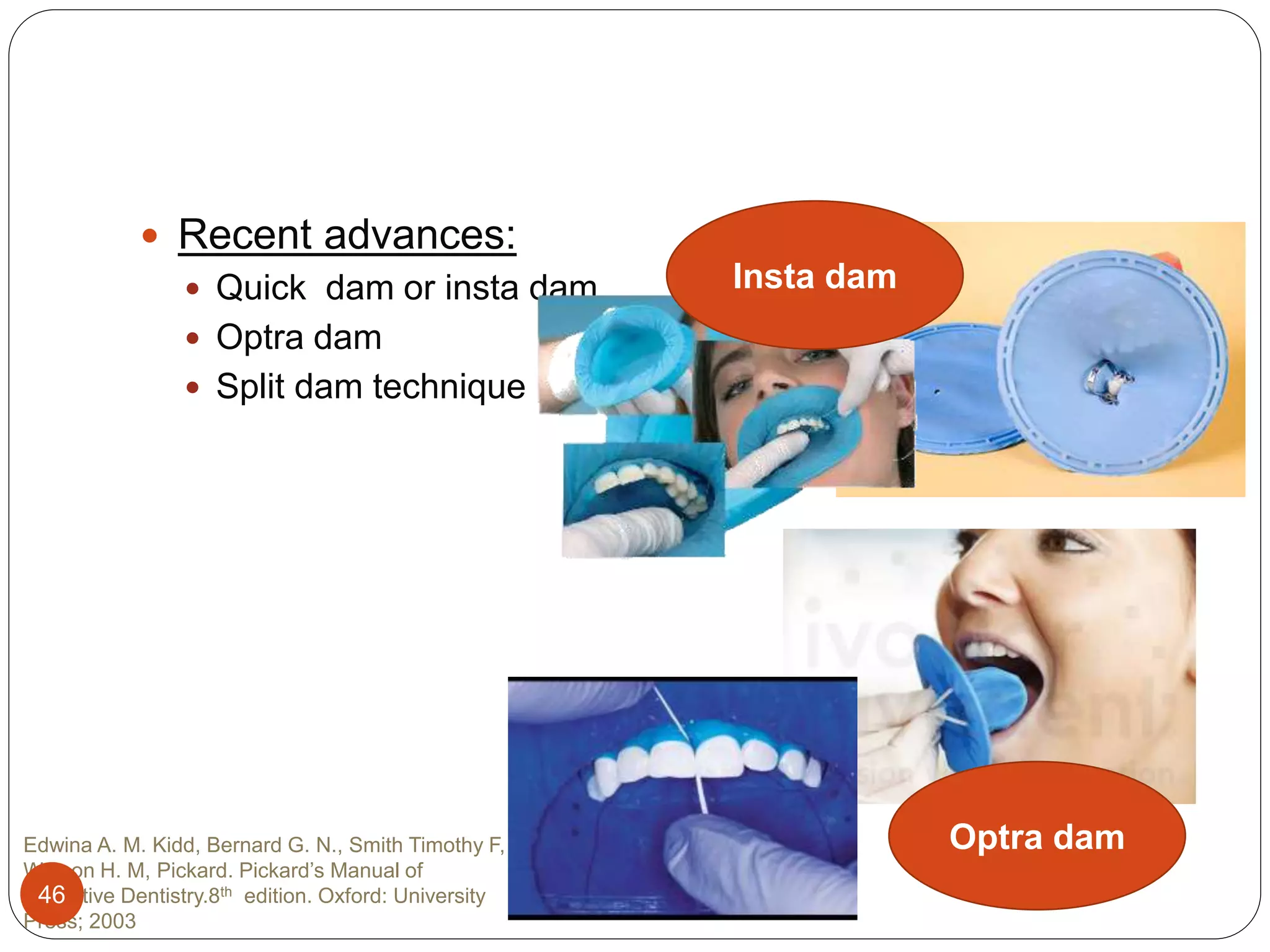 Paediatric operative dentistry | PPTX
