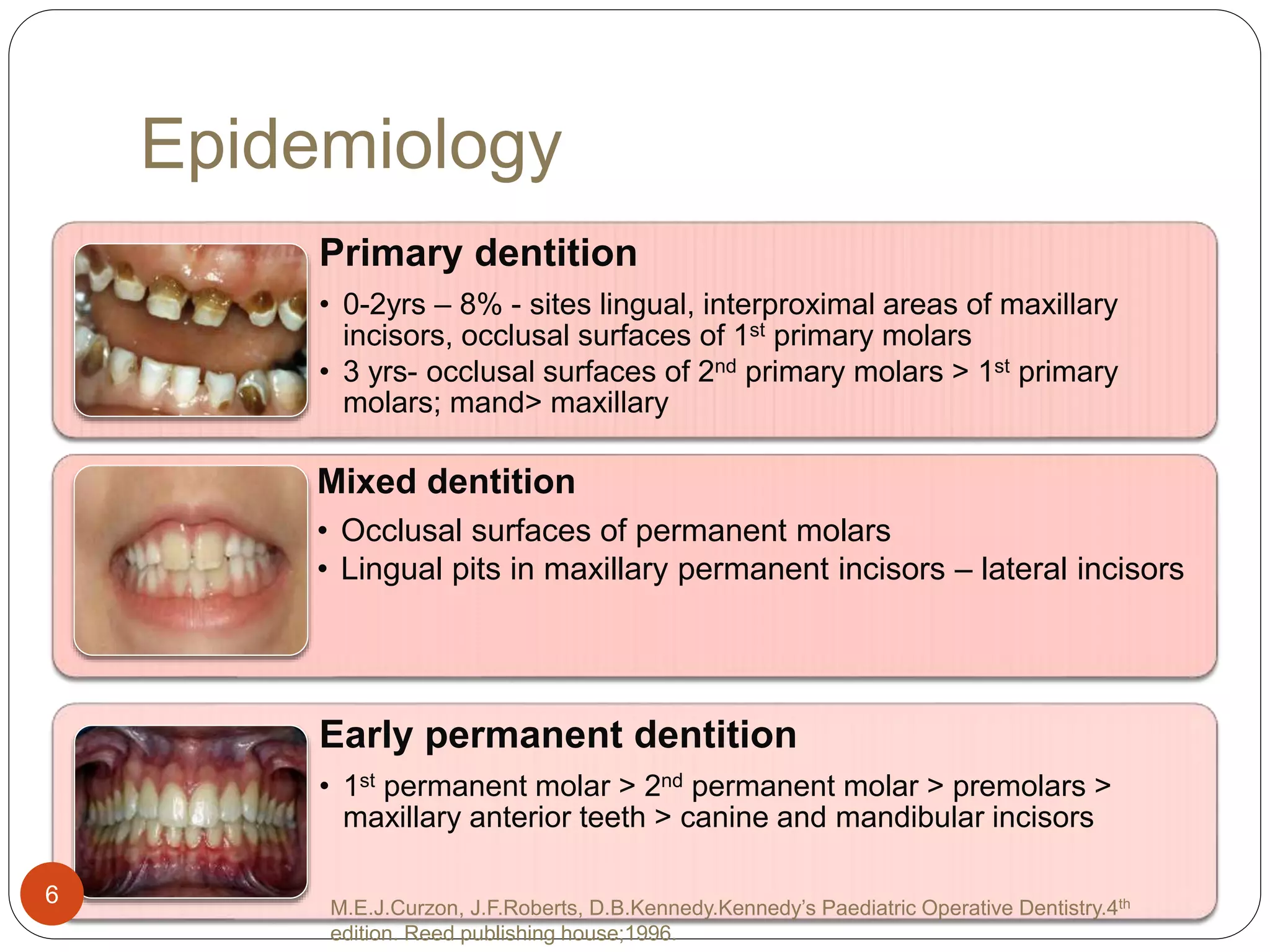 Paediatric operative dentistry | PPTX