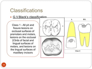 Paediatric operative dentistry | PPTX