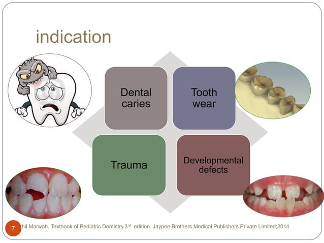 Paediatric operative dentistry | PPTX