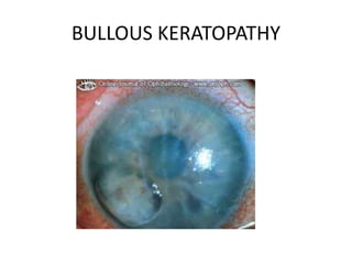 Paediatric ophthalmic disorders | PPTX
