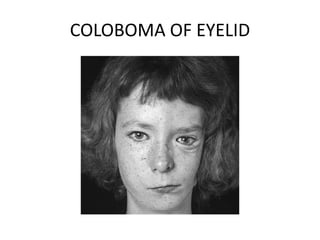 Paediatric ophthalmic disorders | PPTX
