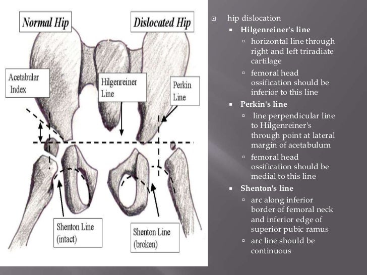 Paediatric Orthopaedic