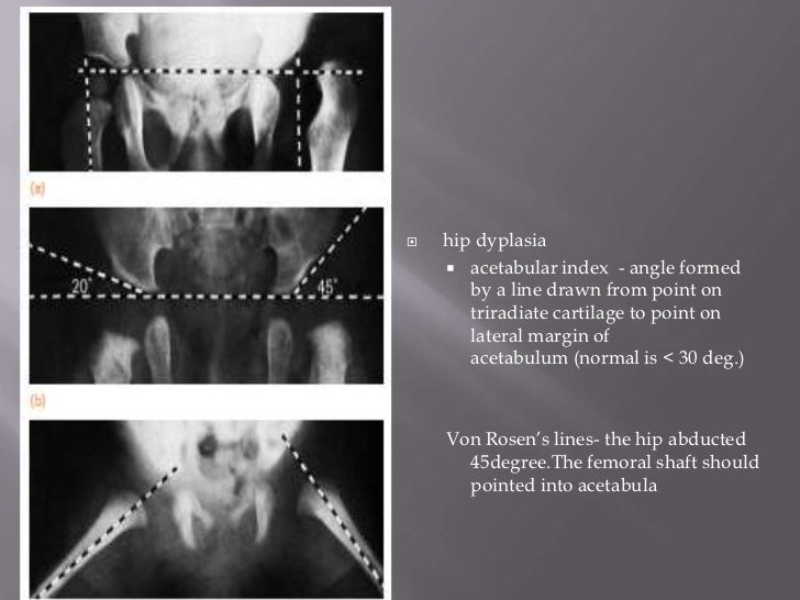 Paediatric Orthopaedic
