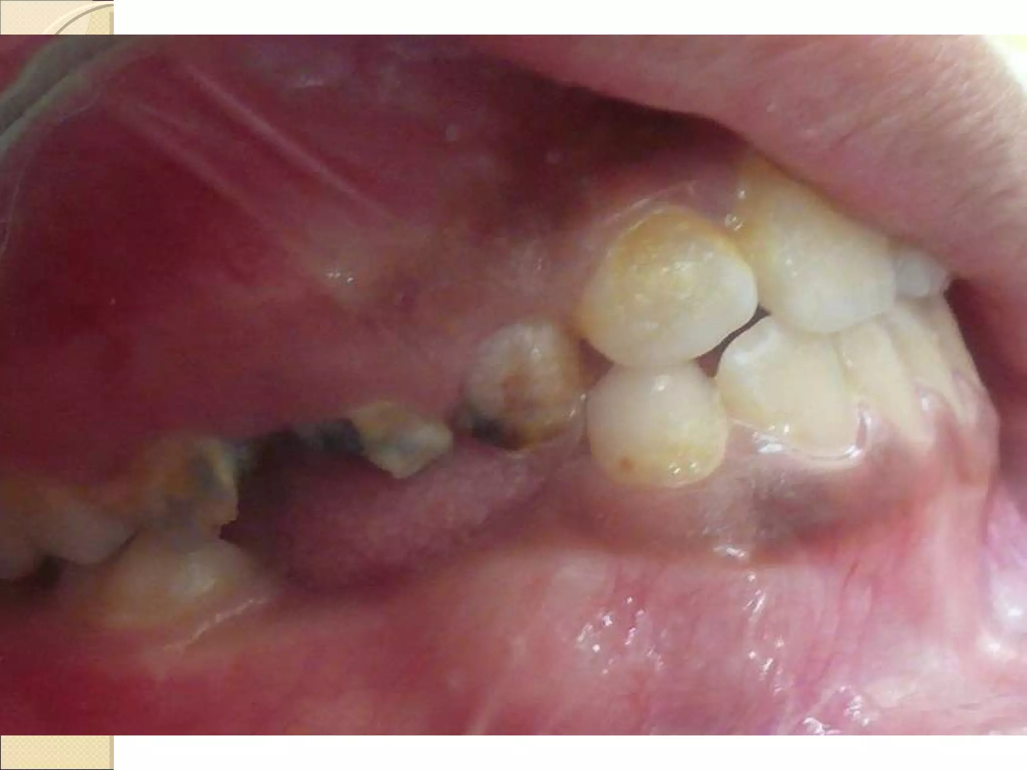 Case Presentation for Paediatric Patient 2 | PPT