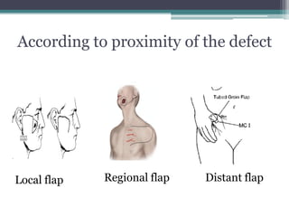 Paediatric plastic surgery | PDF