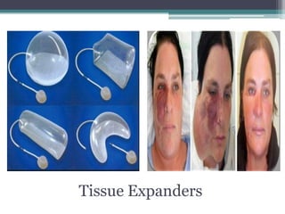 Paediatric plastic surgery | PDF