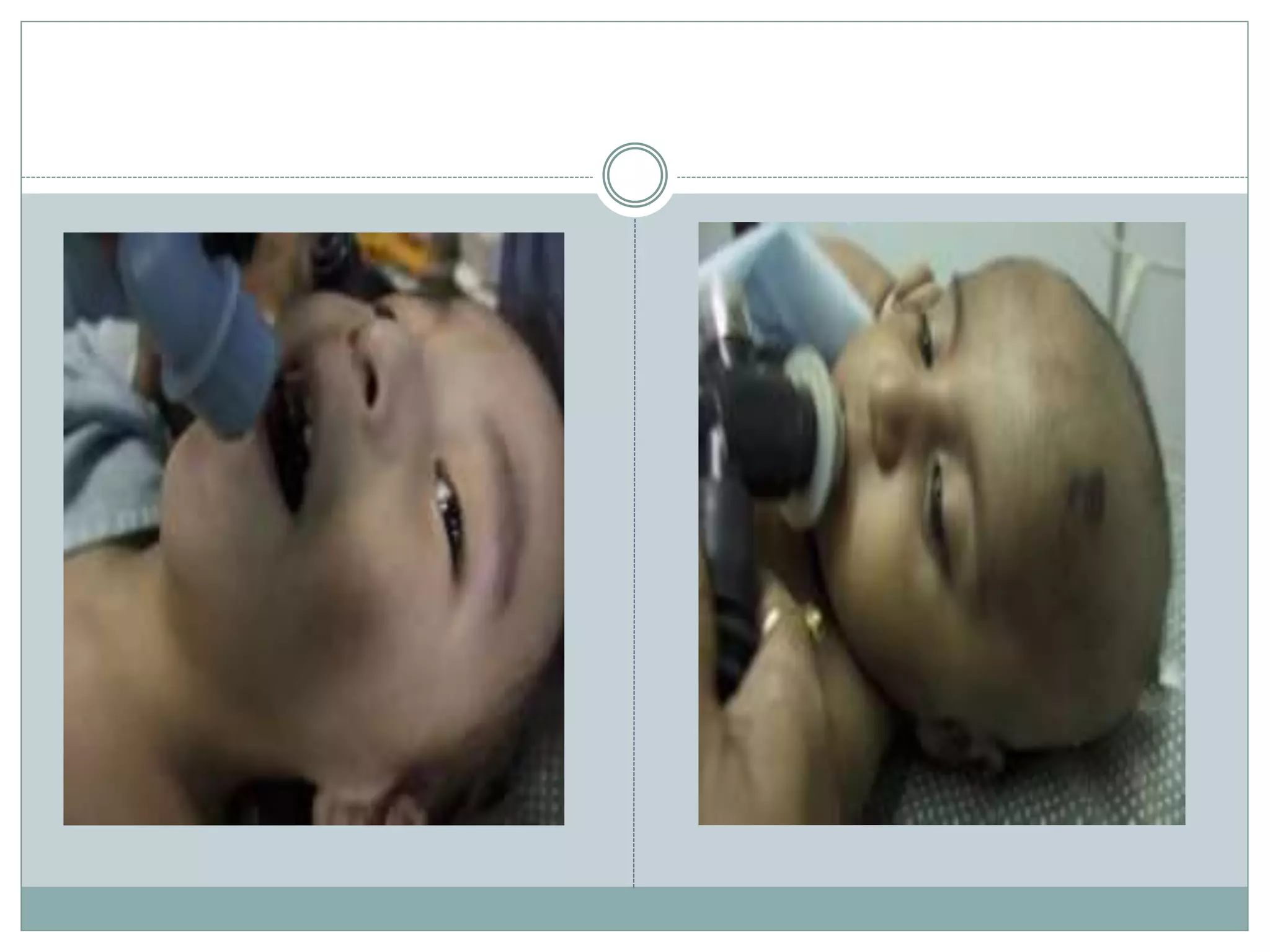 Paediatric Pre-Anaesthetic Evaluation.pptx