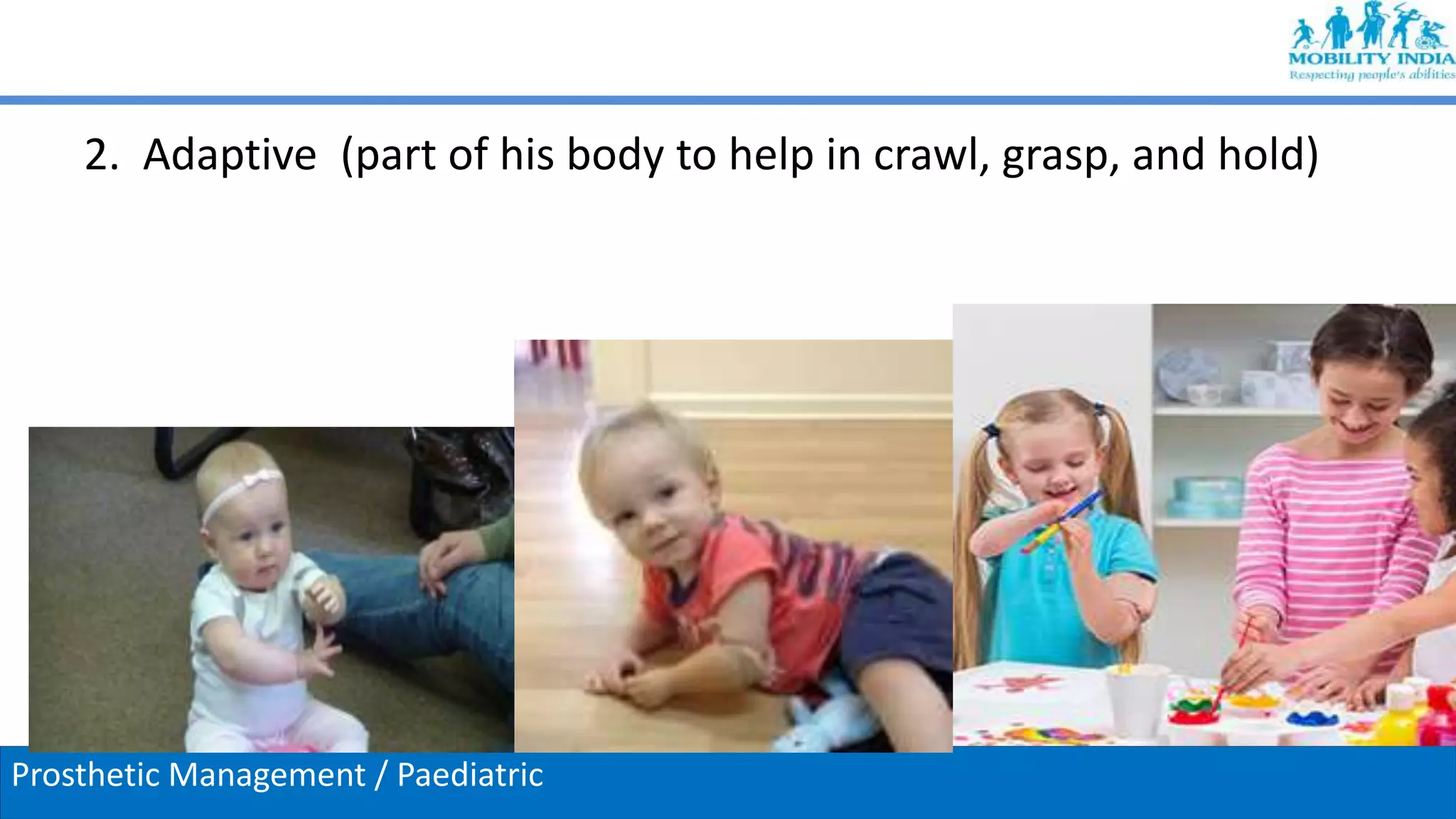 Paediatric prosthetics | PPTX