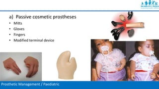 Paediatric prosthetics | PPTX