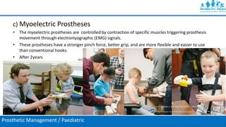 Paediatric prosthetics | PPTX