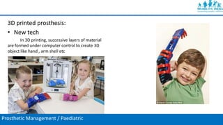 Paediatric prosthetics | PPTX